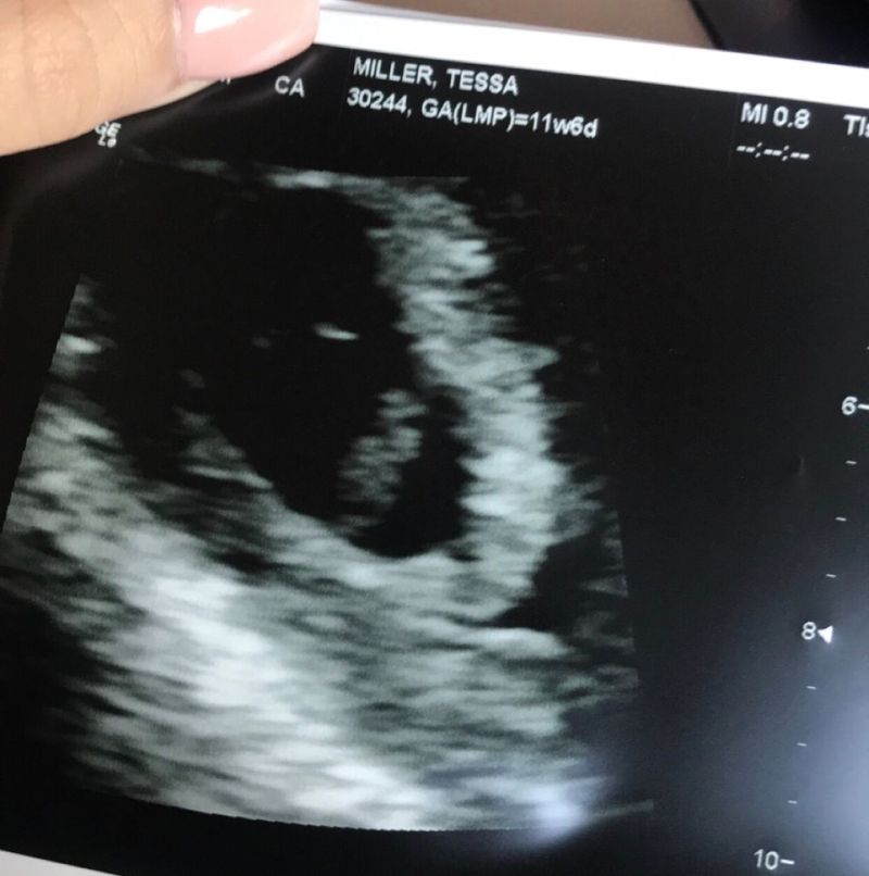 How Do I Know My Due Date - Paint Color Ideas